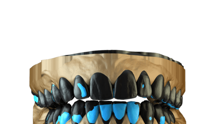 Smilecloud - Every Smile Starts With Yes