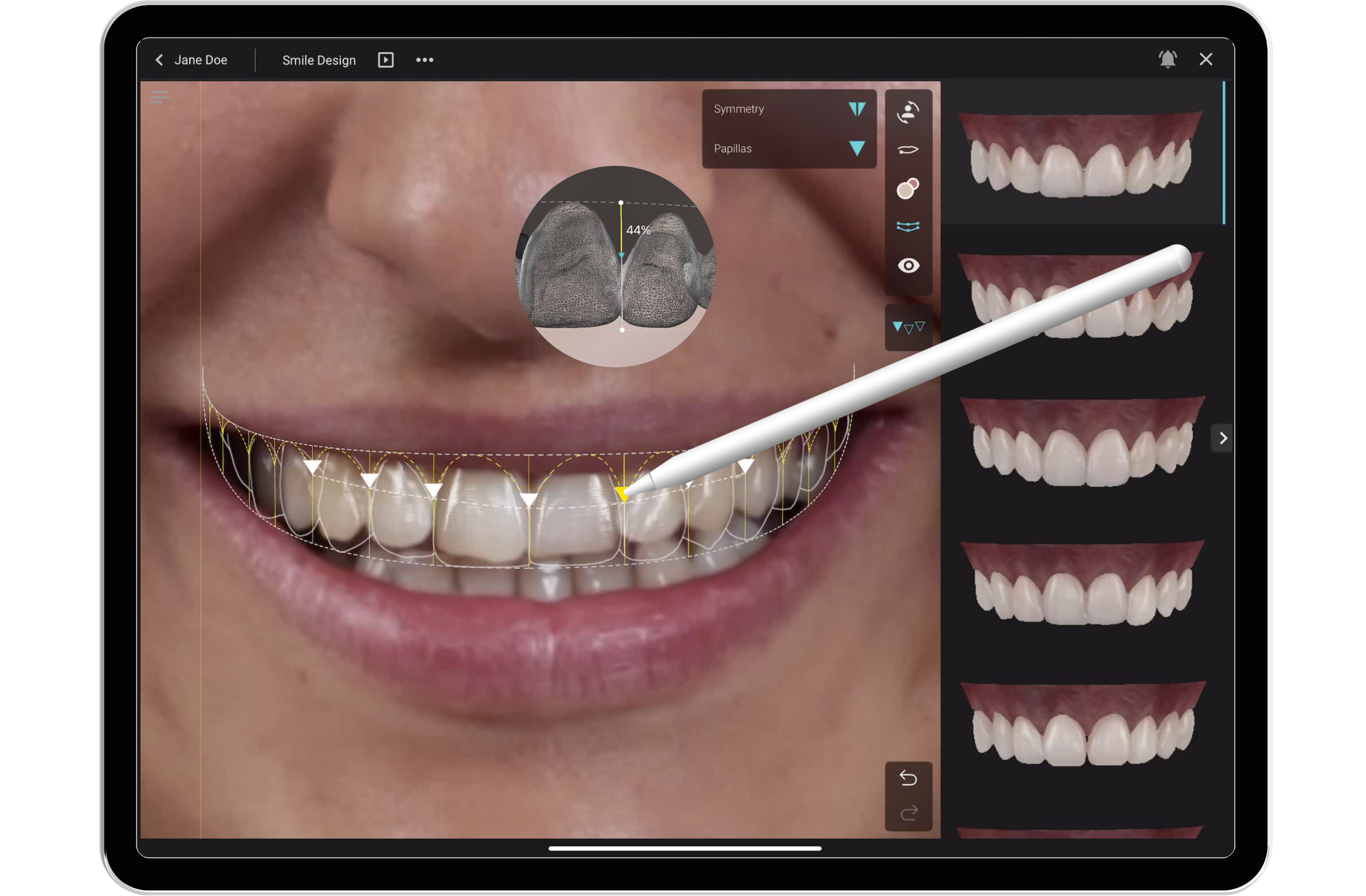 Smilecloud - Every Smile Starts With Yes